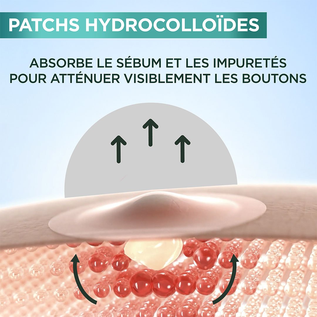 Patch boutons Pure Active : soin actif anti-imperfections | Garnier