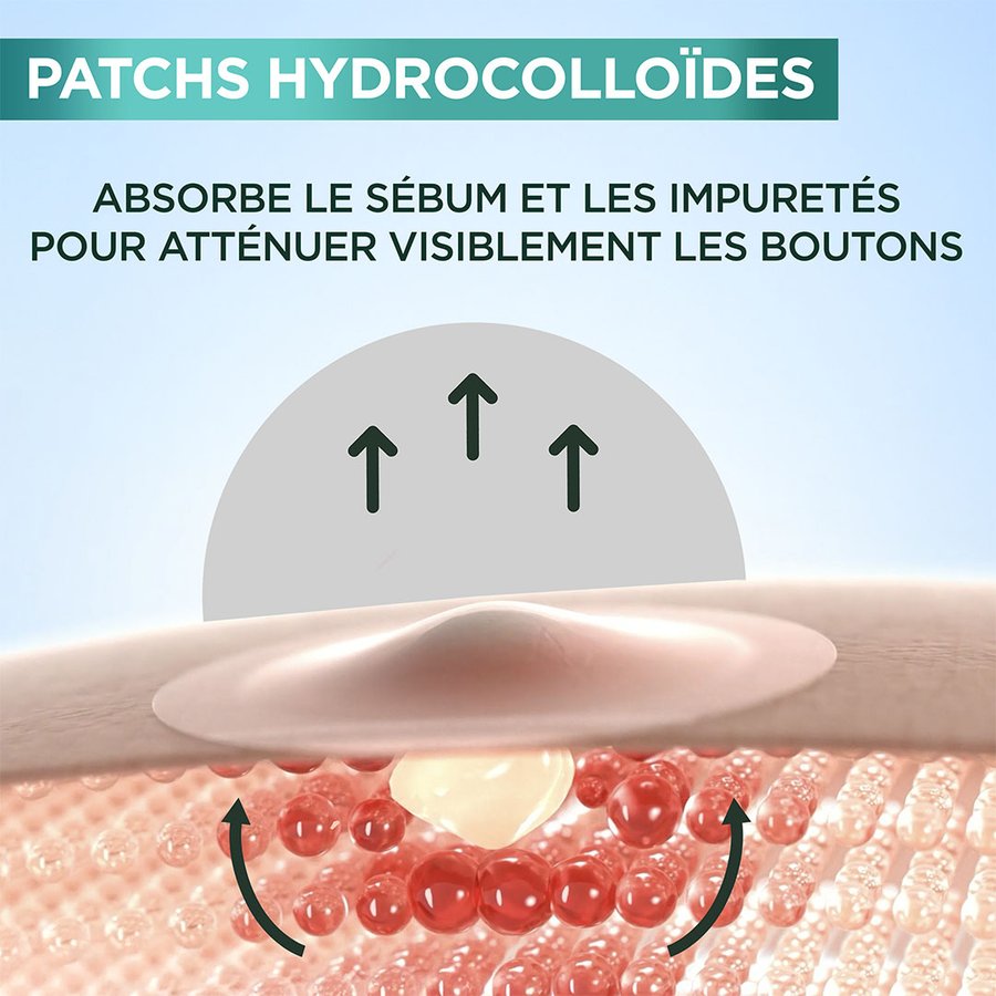 Patch boutons Pure Active : soin actif anti-imperfections | Garnier